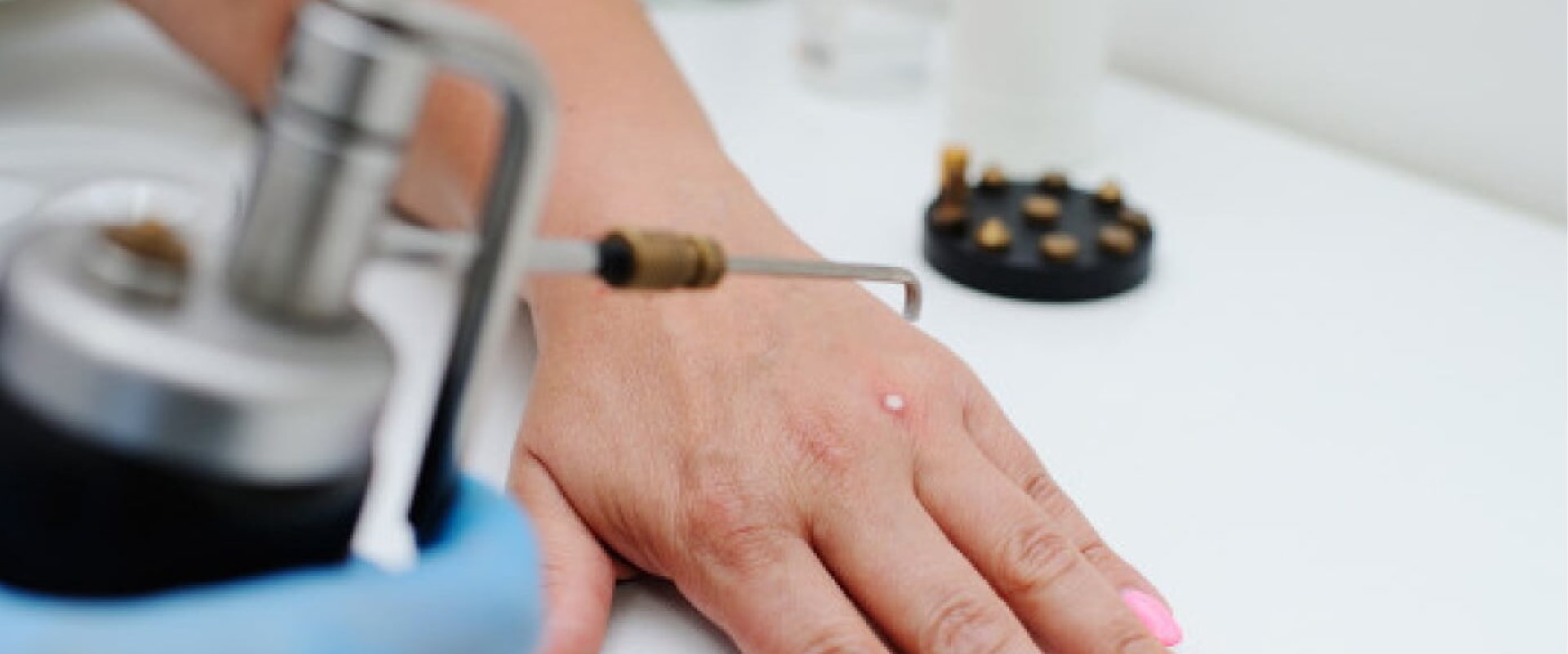 The Professional's Guide On How To Cauterize A Wound