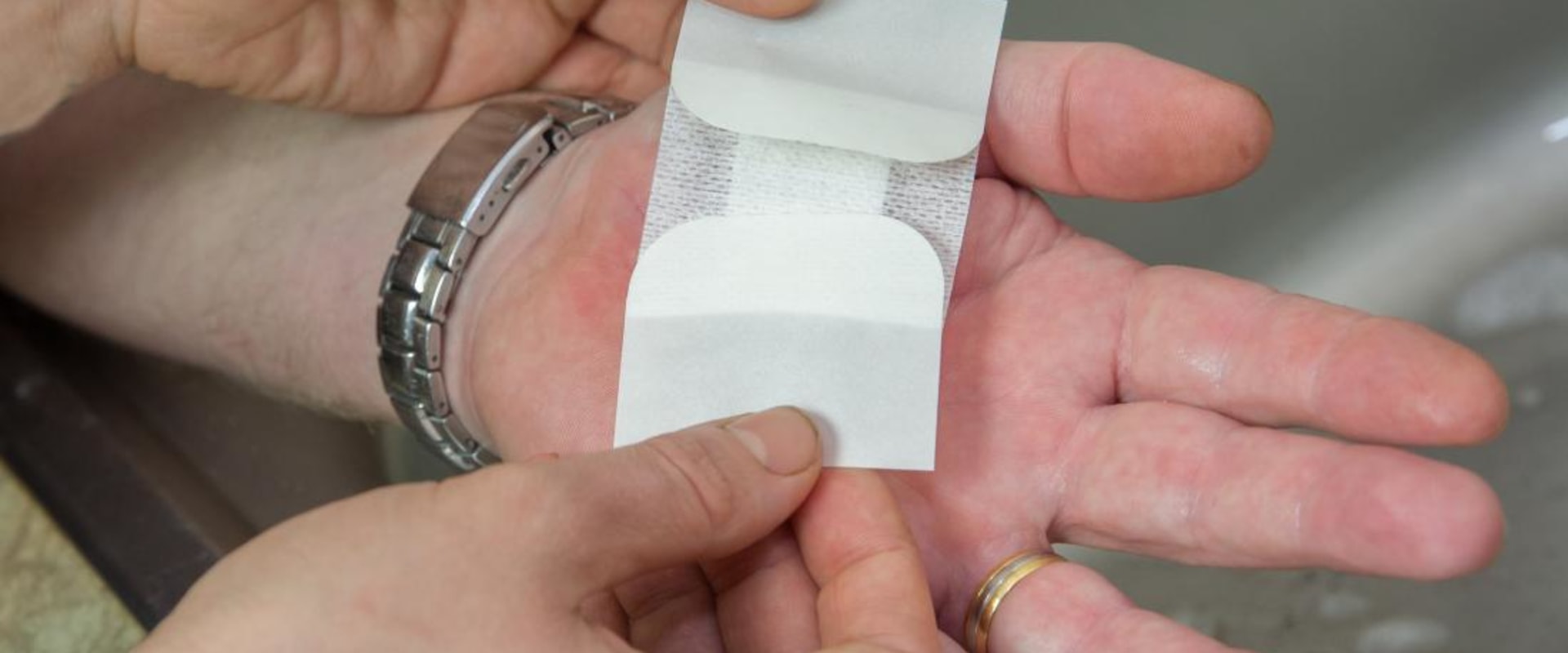 Managing Wounds Effectively: What Is Purulent Drainage and Discharge?