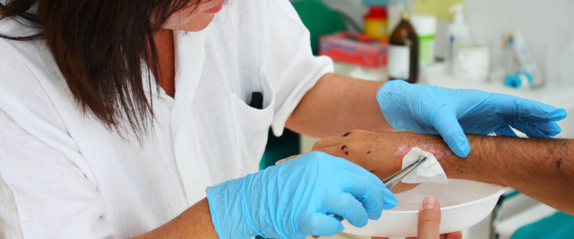 The Importance of Proper Wound Care: An Expert's Perspective