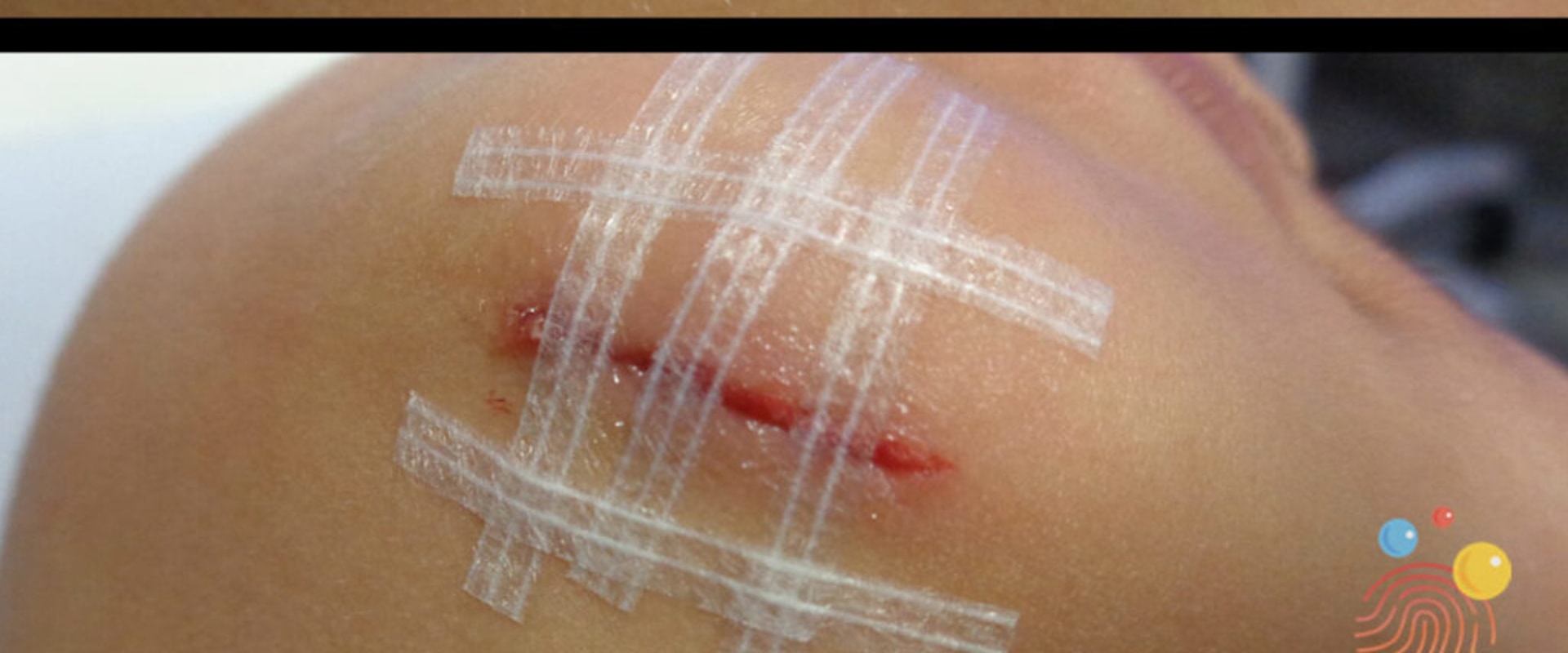 Laceration Vs Abrasion: How Specialists Identify and Treat These Common ...